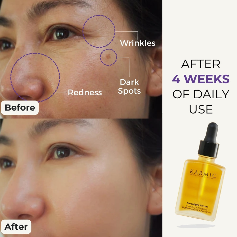 Bakuchiol Face Serum for Wrinkles and Pigmentation